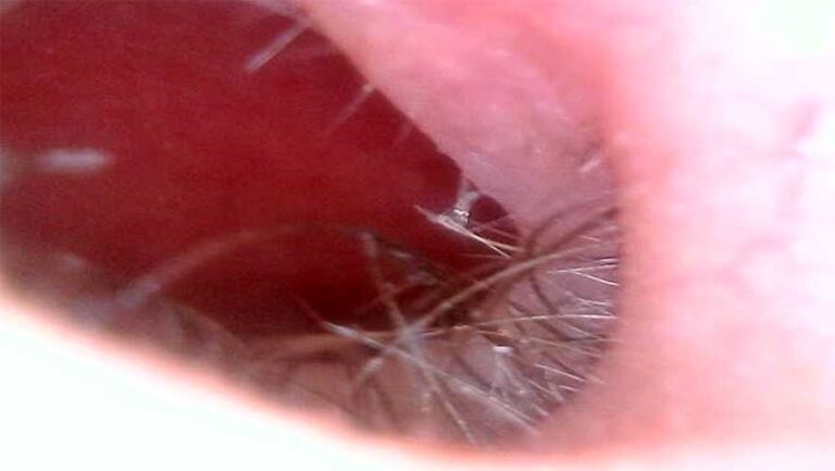 Review of the ScopeAround M28 Otoscope Ear Camera: Closely Examine with ...