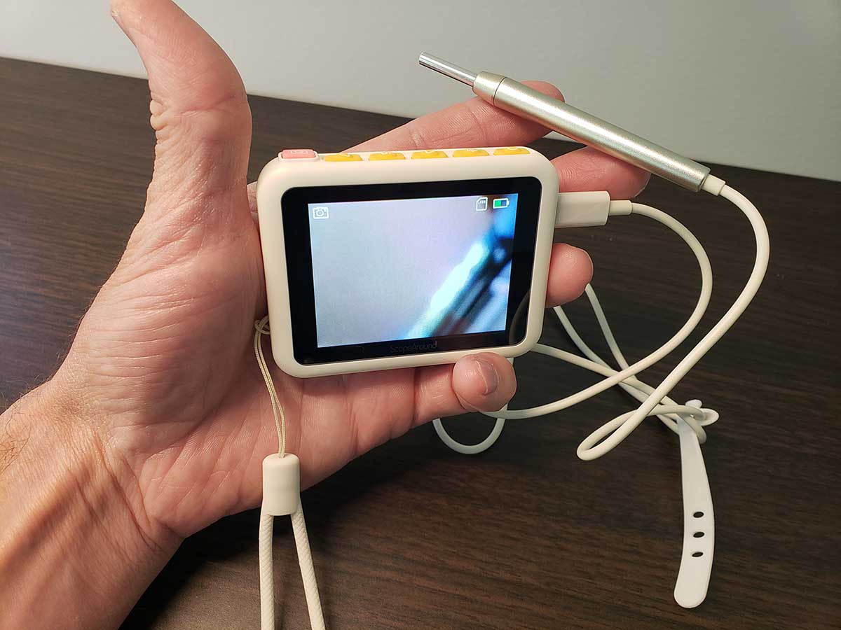 Review of the ScopeAround M28 Otoscope Ear Camera: Closely Examine with ...